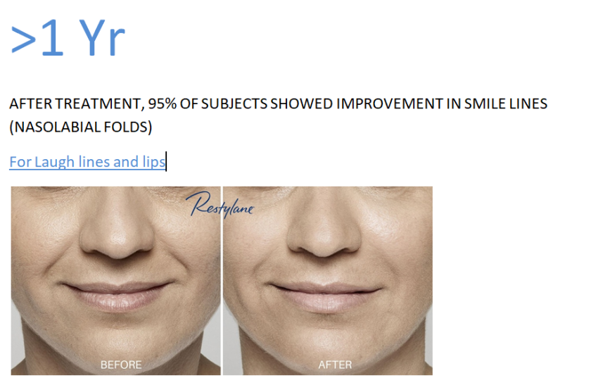 Restylane Fillers - Amerejuve Medspa